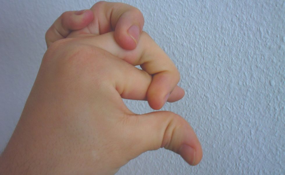 13 Realities Only People With hEDS Understand