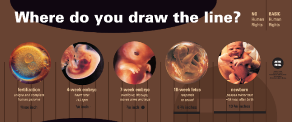 6 Reasons To Be Pro-Life