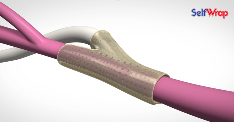 VenoStent heads to clinical trials - InnovationMap