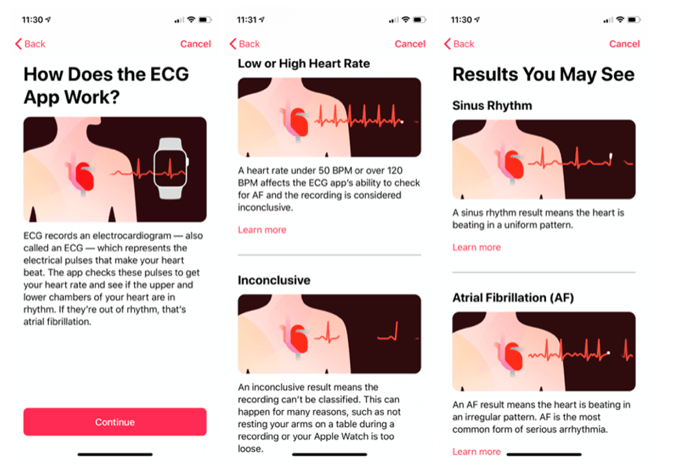How the ECG feature of the Apple Watch Series 4 works - Gearbrain