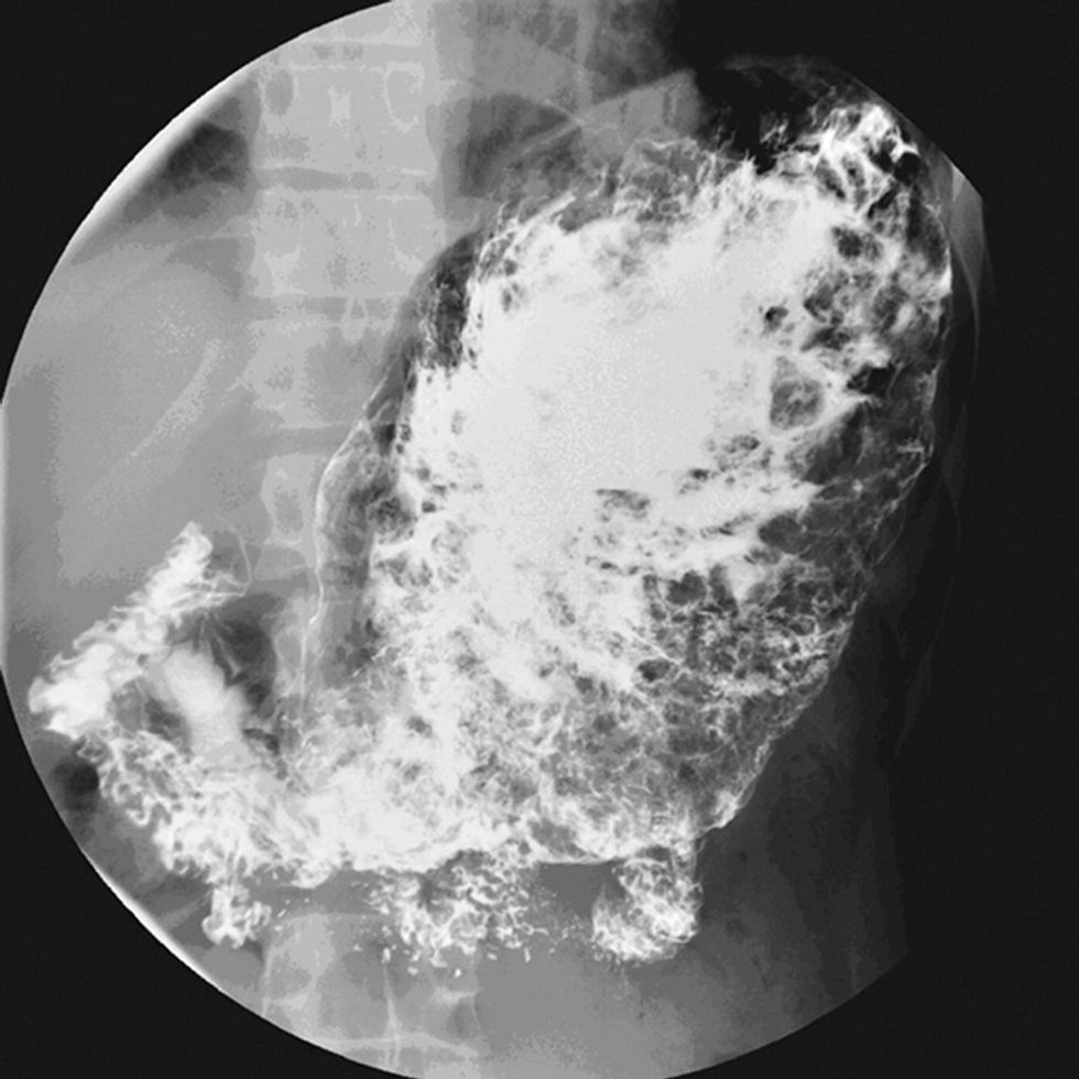 Deep Inside Nathan's Annual Hot Dog Eating Contest - GOOD