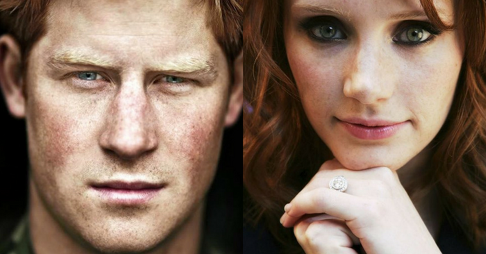 PHOTOS: 14 Common Human Genetic Mutations - Second Nexus