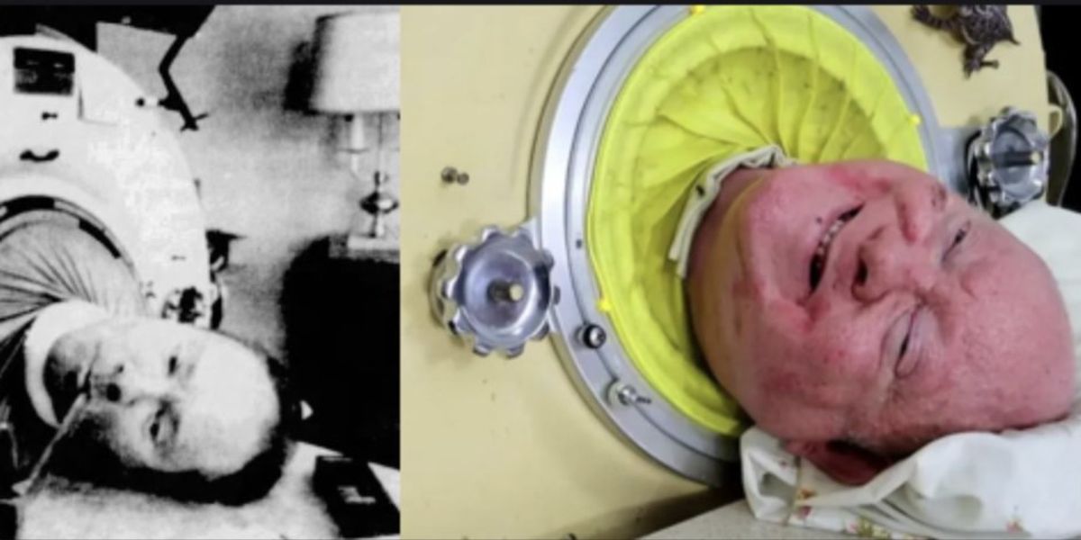 Paul Alexander spent over 70 years in an iron lung. What he was able to ...