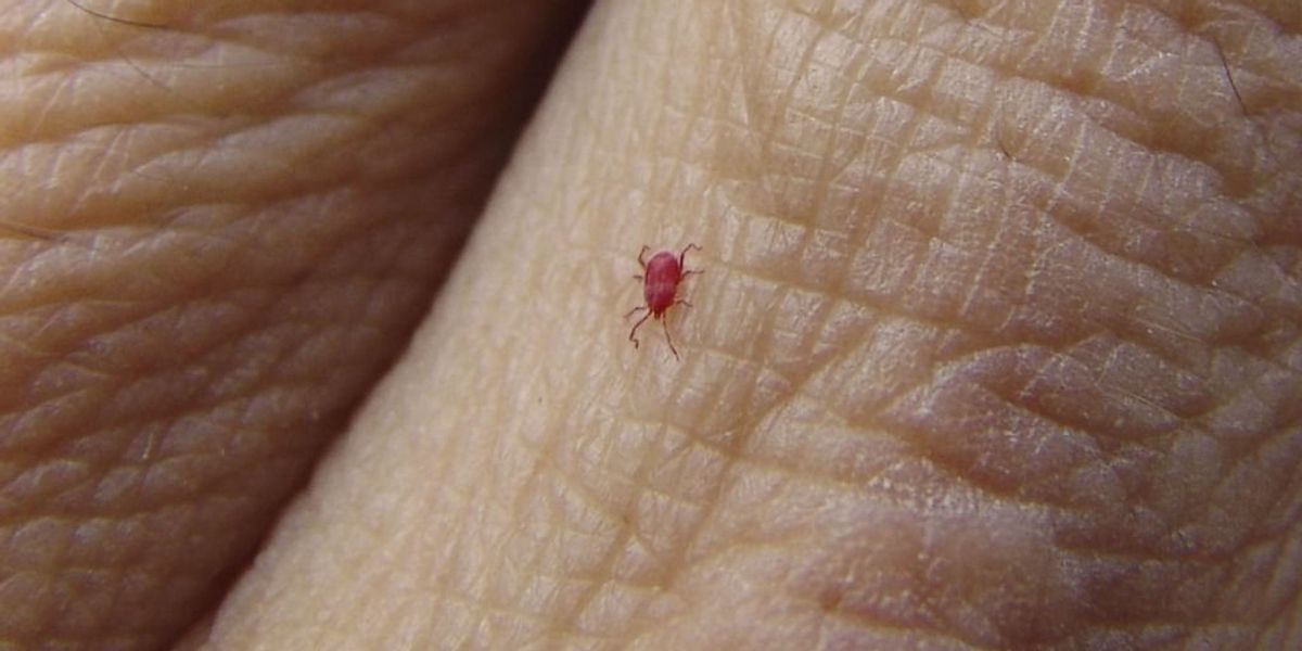 What you should know about chiggers - It's a Southern Thing