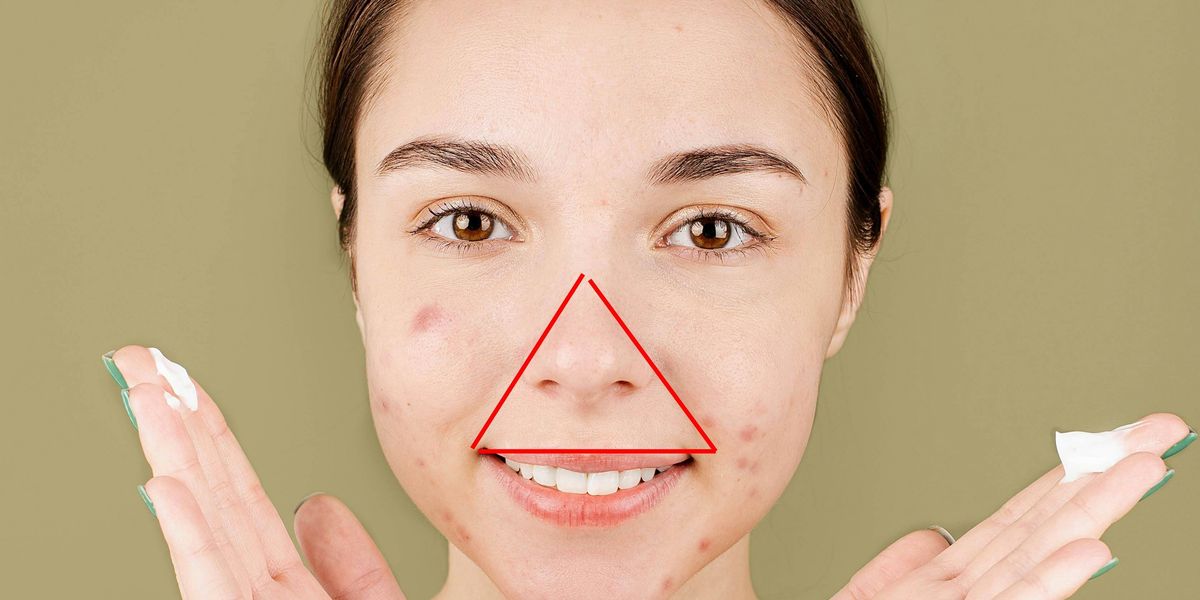 Doctors warn pimple poppers of 'triangle of death' on face - Upworthy