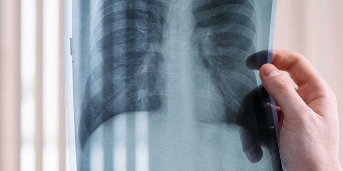 Oorja Bio launches after $30M series A, FDA IND clearance - InnovationMap