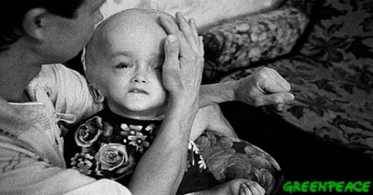 Physical Deformities: We Are All Humans