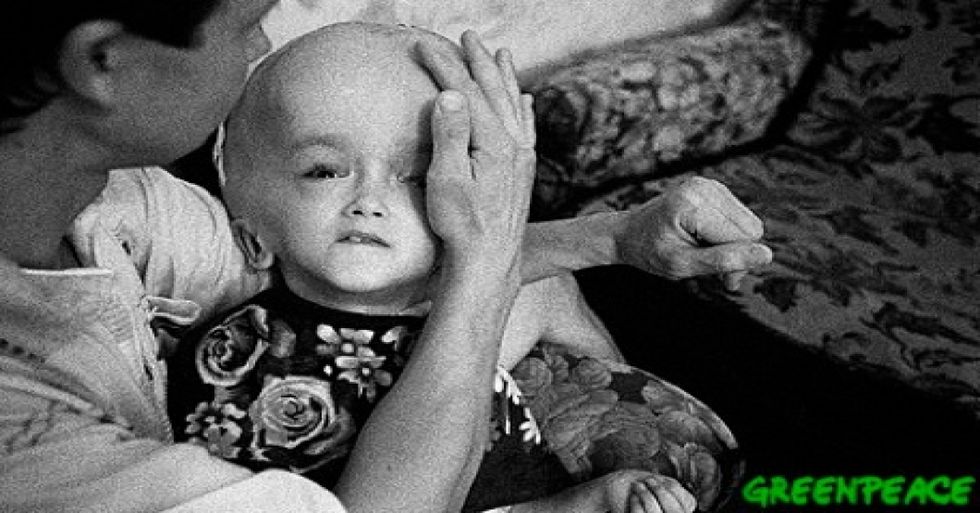 Physical Deformities: We Are All Humans