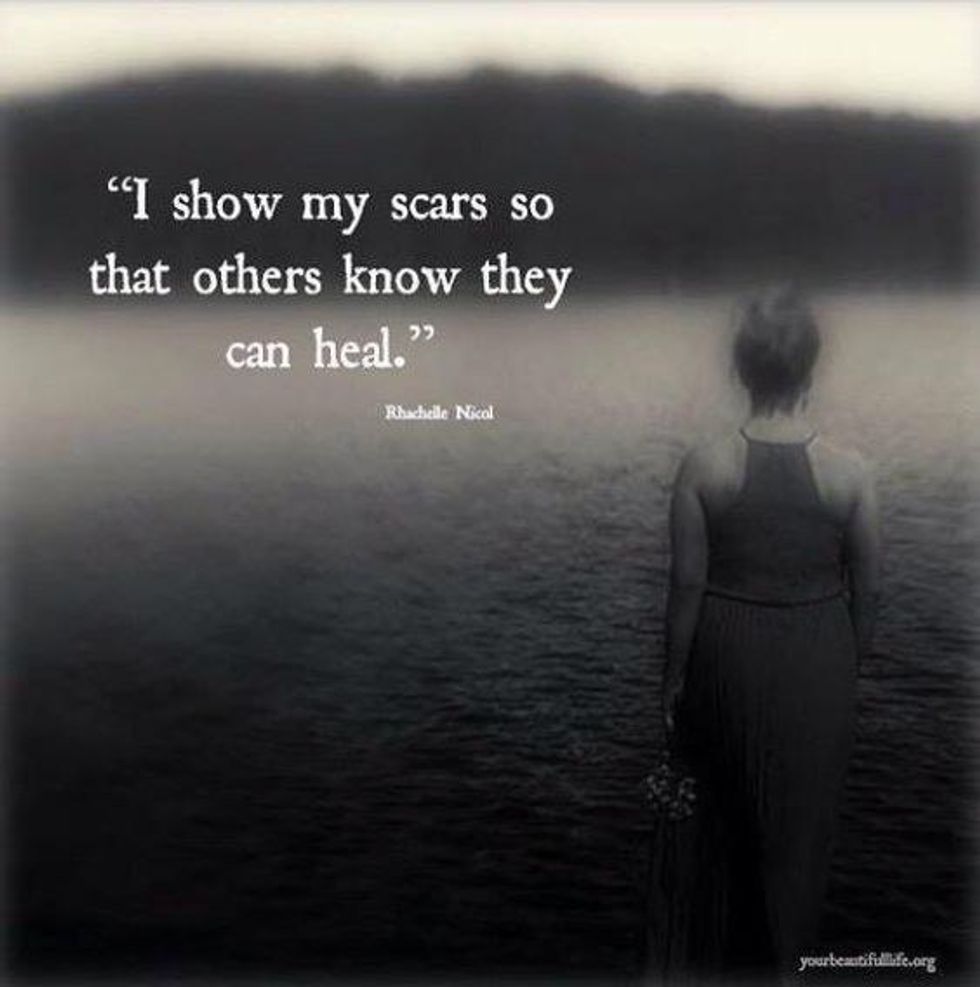 How My Scar Has Changed How I Define Beauty