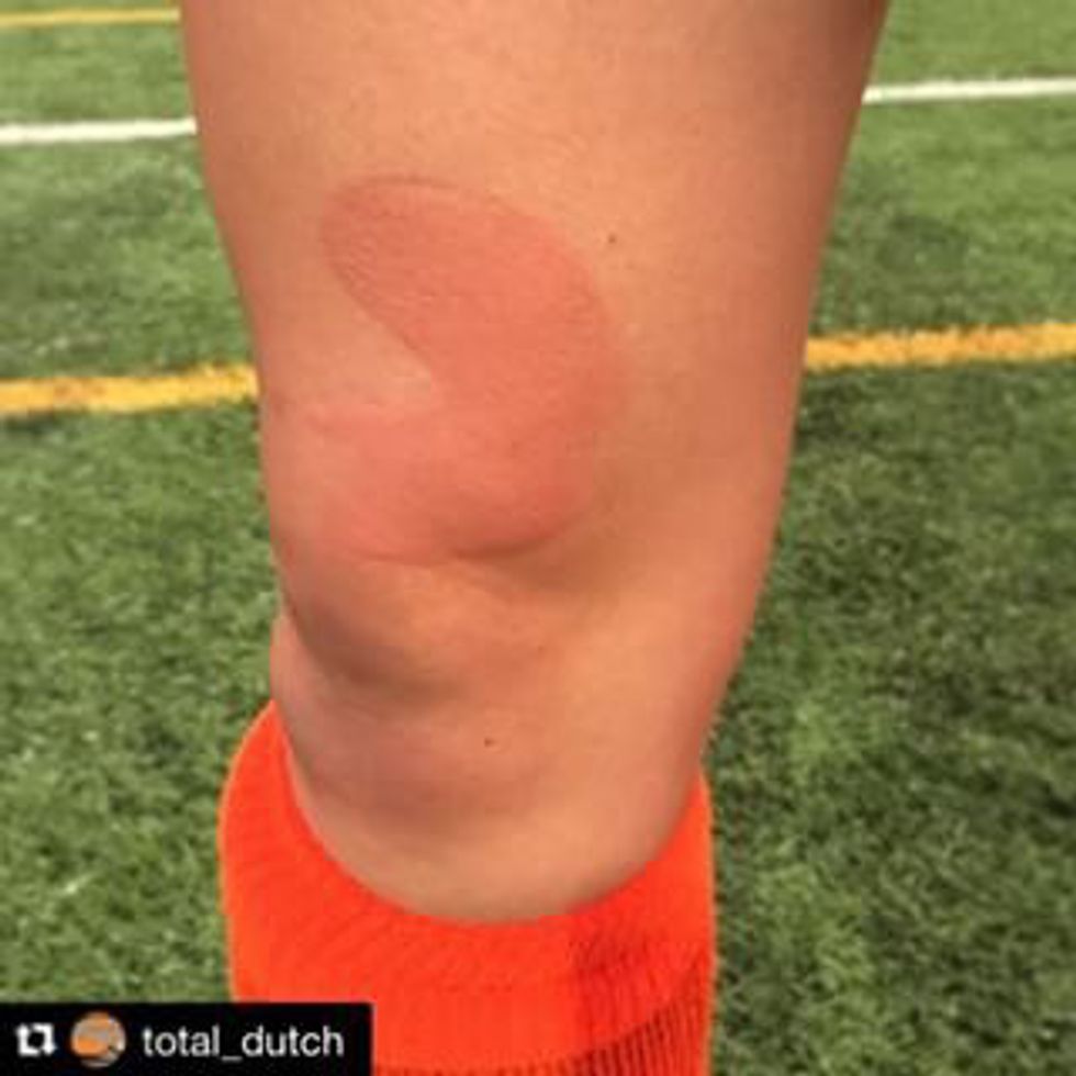 16 Things All Field Hockey Players Understand