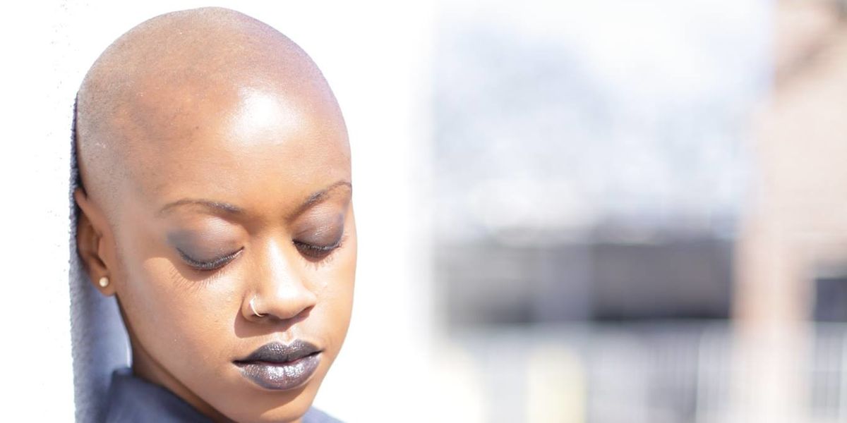 My Struggle With Alopecia: How I Learned To Find the Beauty In My ...