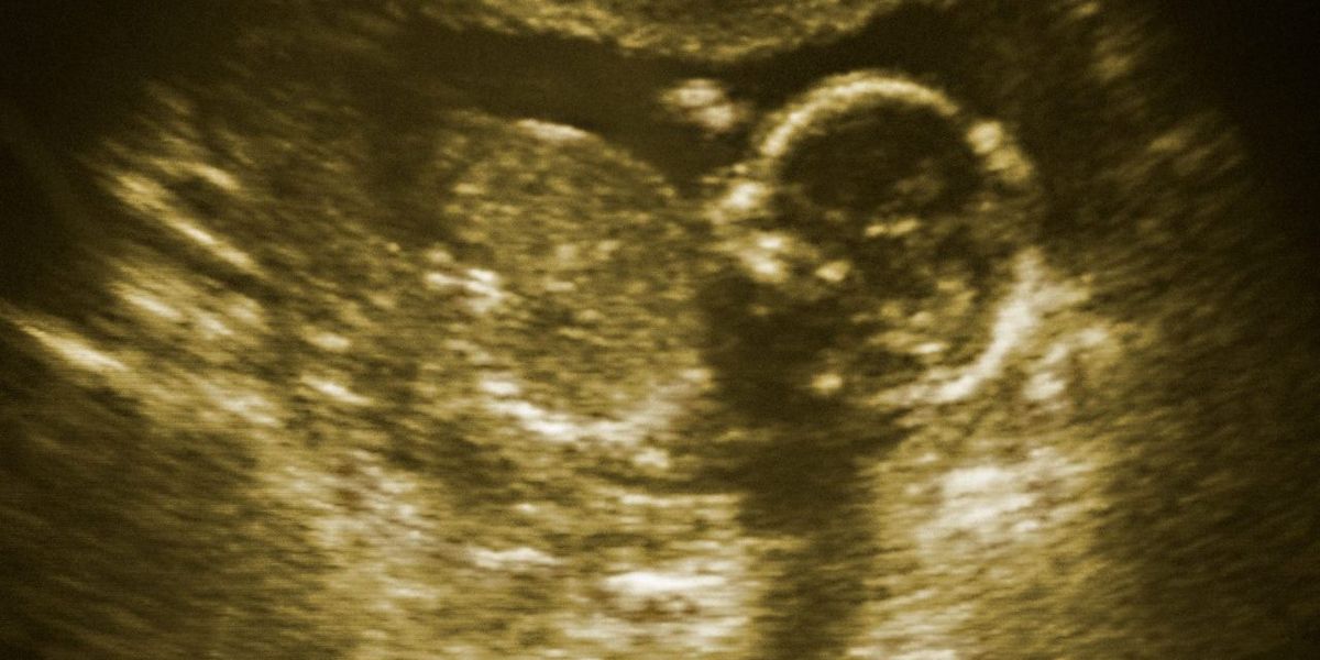 New Research: Babies Learn to Recognize Specific Languages in the Womb ...