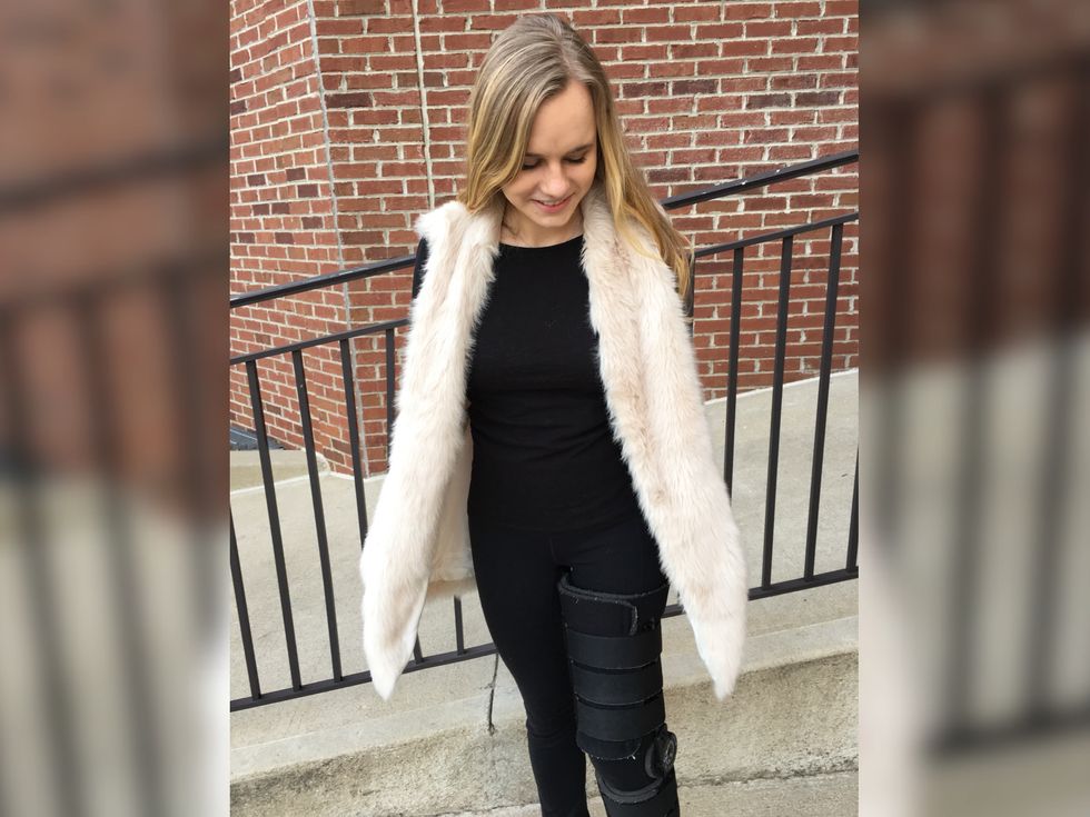 Life Lessons I Learned From A Broken Knee