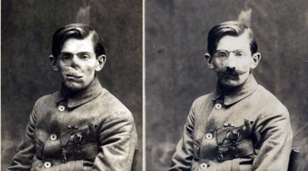 Old Photos Reveal How A Compassionate Sculptor Helped 'Restore' The ...