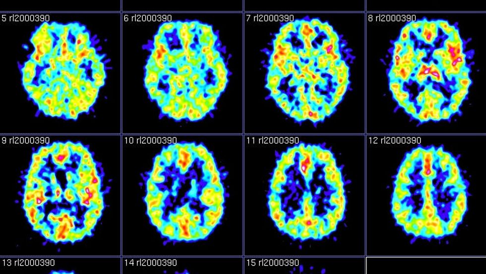 What Causes Extreme Fear in the Brain ? - Big Think