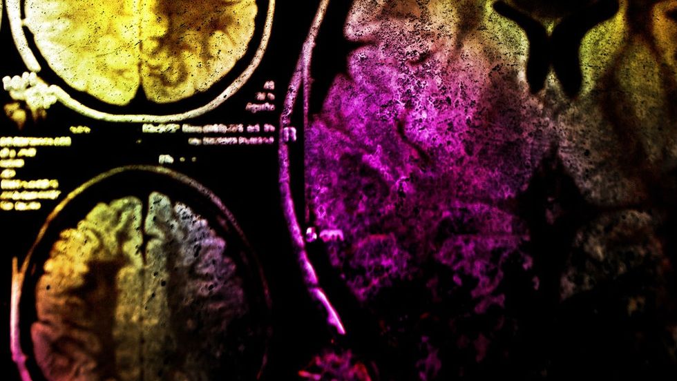 This Is Your Brain During Orgasm Big Think