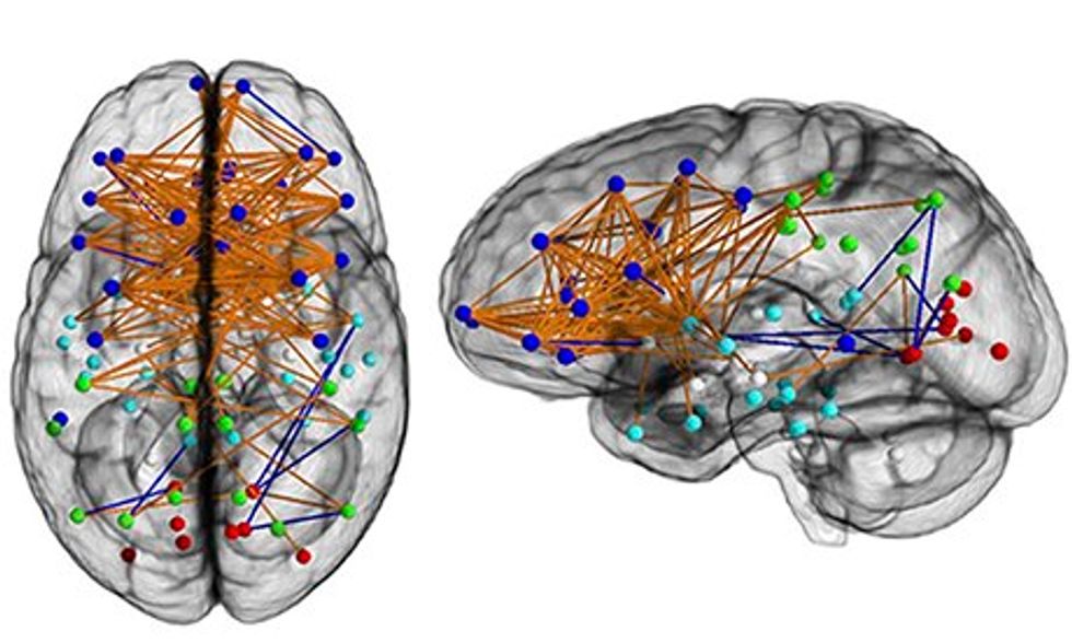 Male And Female Brains Are Wired Differently Big Think