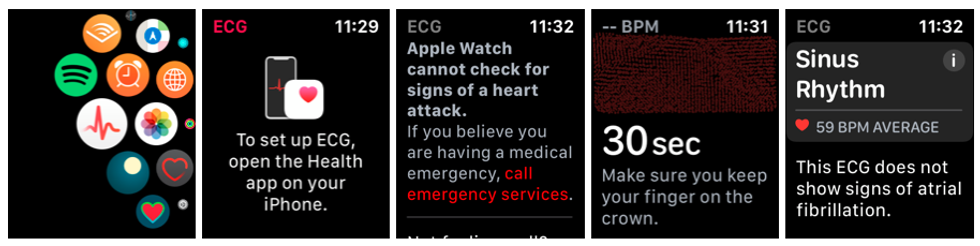 How the ECG feature of the Apple Watch Series 4 works - Gearbrain