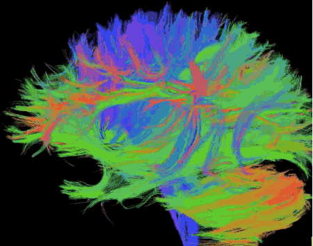 He invited drug users into his lab. What he discovered is changing what ...