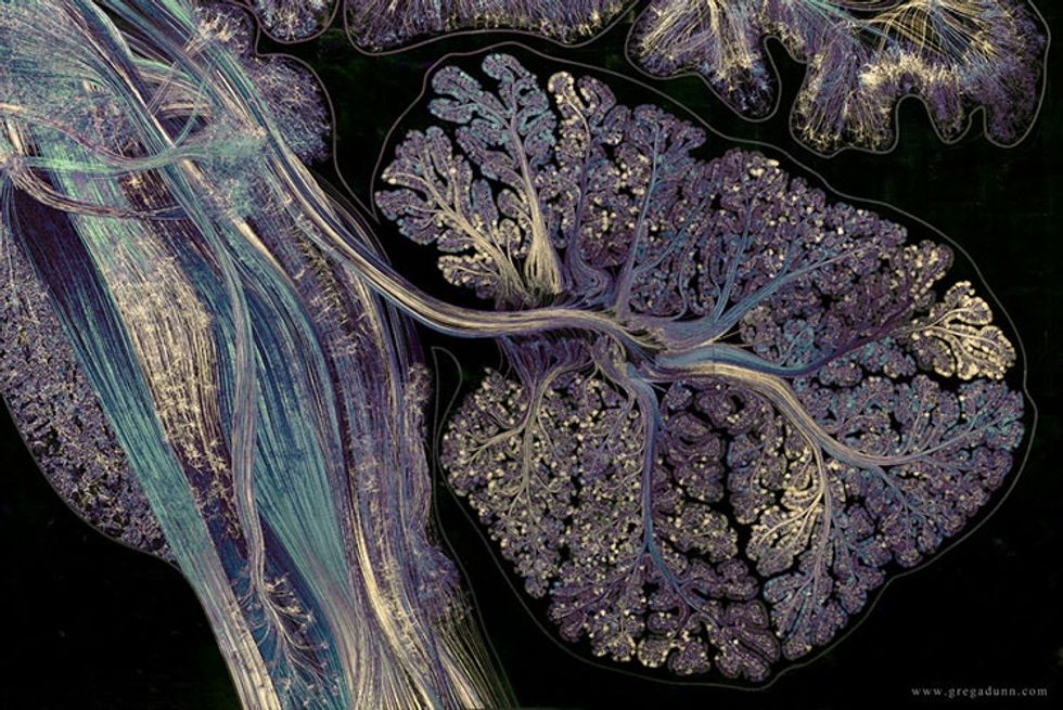 2 scientists turned a human organ into an art project. Here are 11 ...