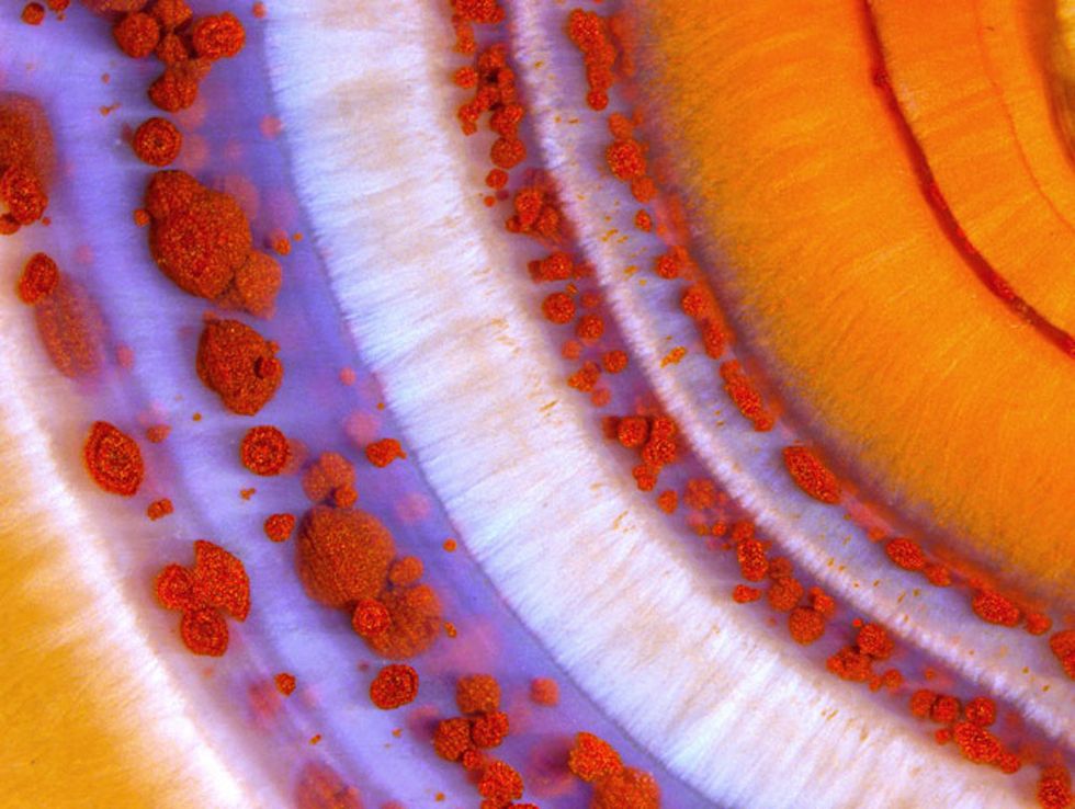 9 Award-Winning Microscopic Photos Might Make You Rethink How You See ...