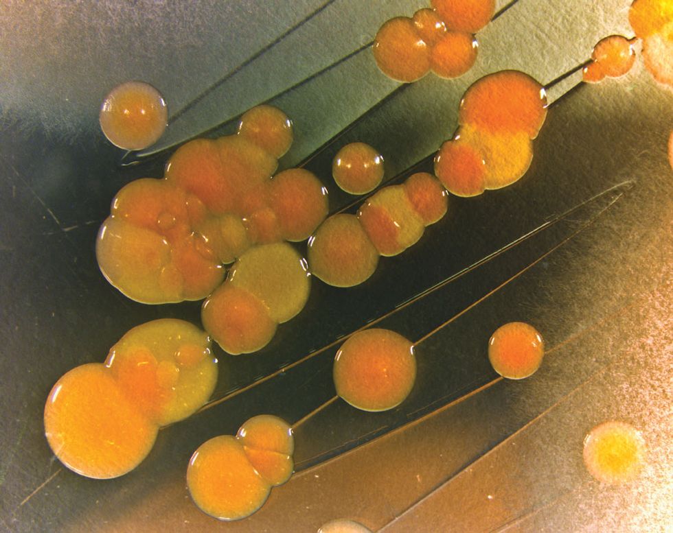 Bacteria Are Amazing: Photos of the Ecology of Cheese - GOOD