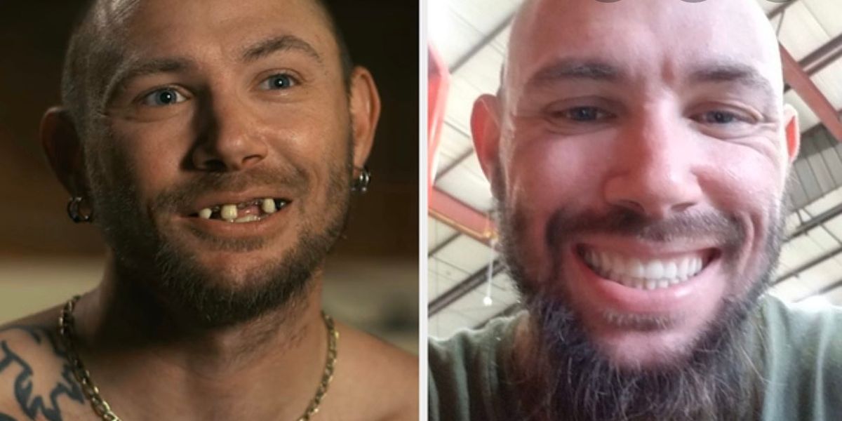 "Tiger King" Star John Finlay Got New Teeth - PAPER Magazine