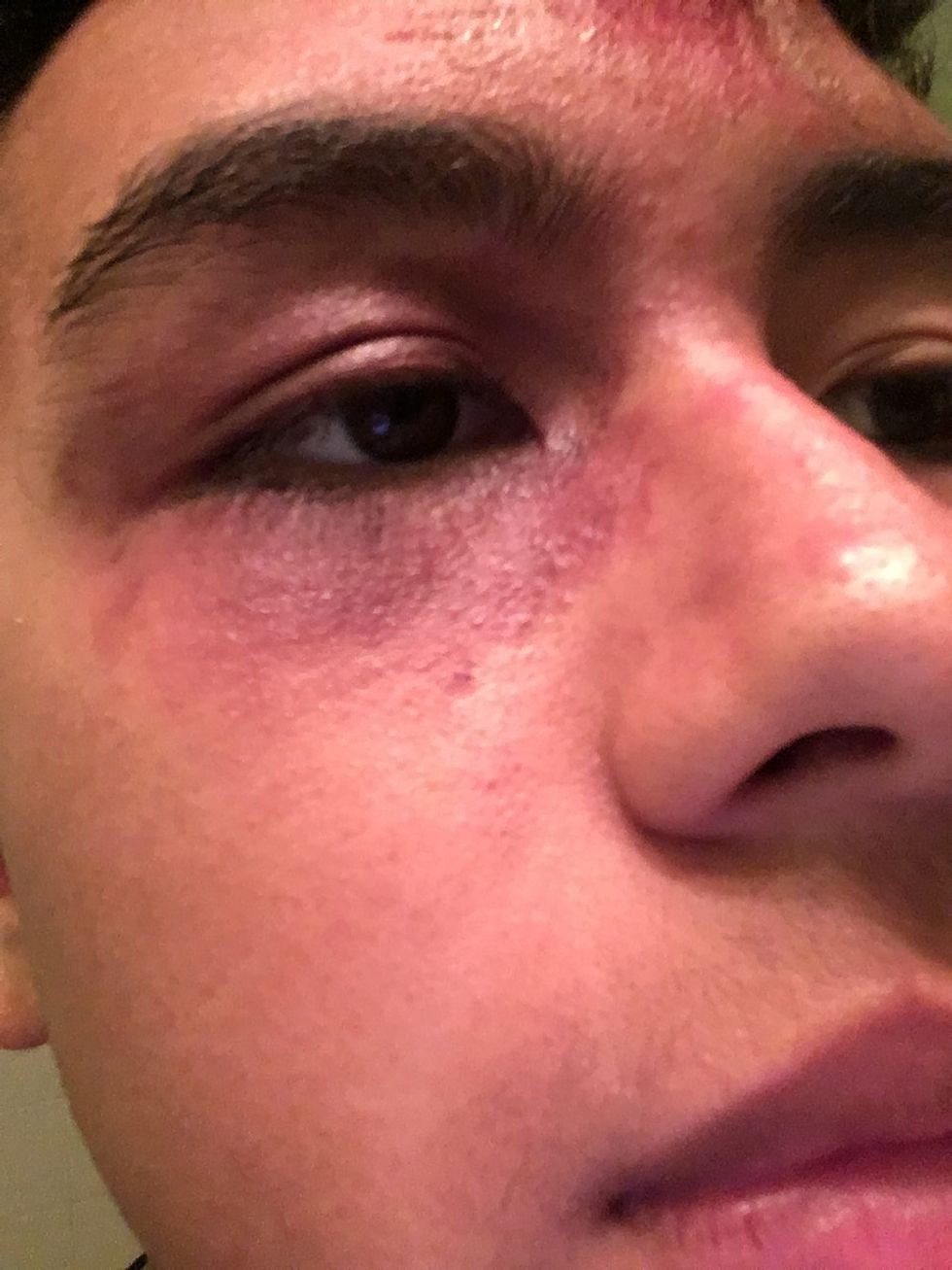 How to Make SFX Wounds and Bruises - B+C Guides