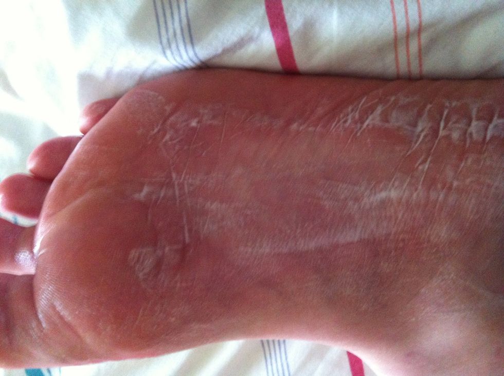 How to get rid of flaky feet - B+C Guides
