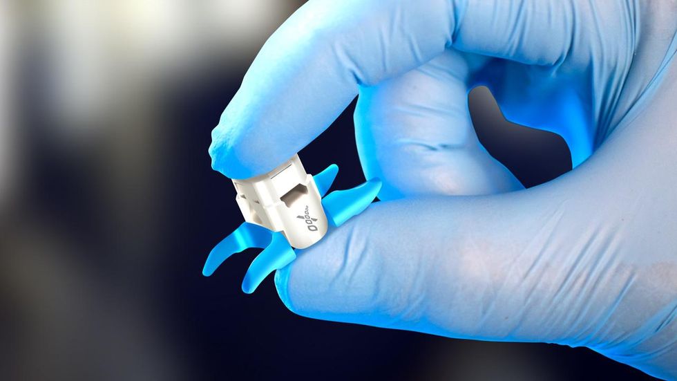 What You Need to Know About Vertiflex Superion for Spinal Stenosis