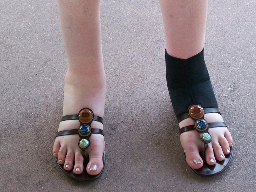How to Get Rid of Cankles