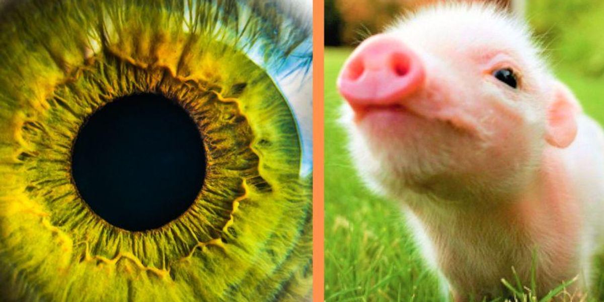 14 blind people restore vision with pigskin eye implants - Upworthy