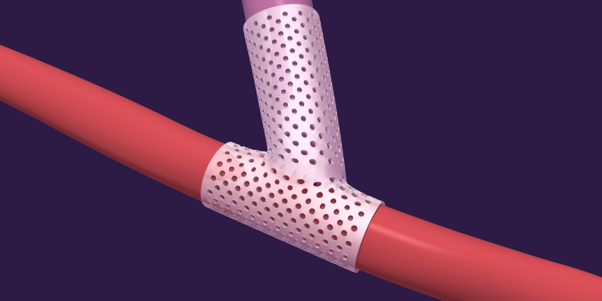 Houston startup with unique vascular innovation enrolls subjects in new ...